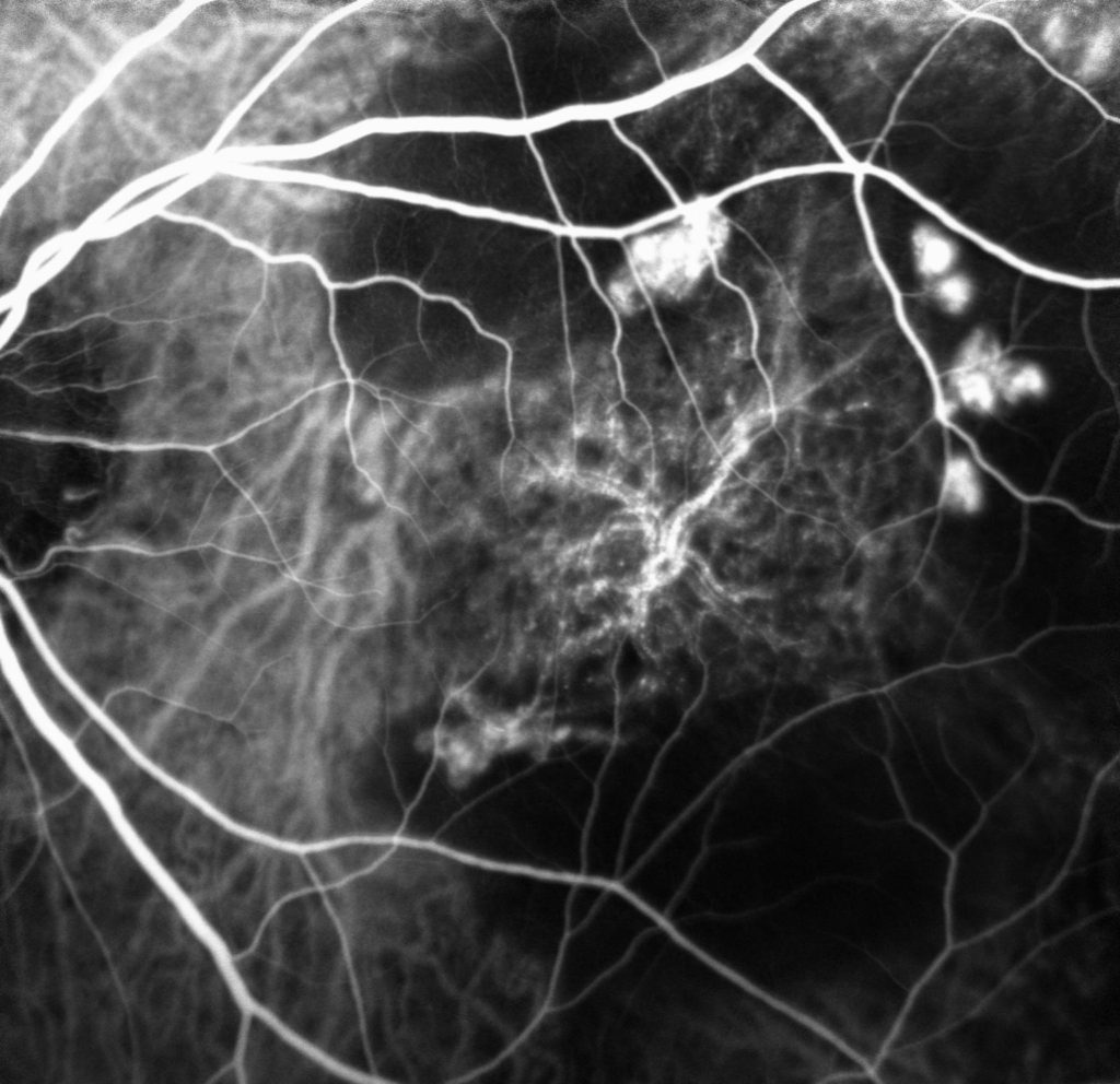 Leading Technology - Retina & Eye Consultants