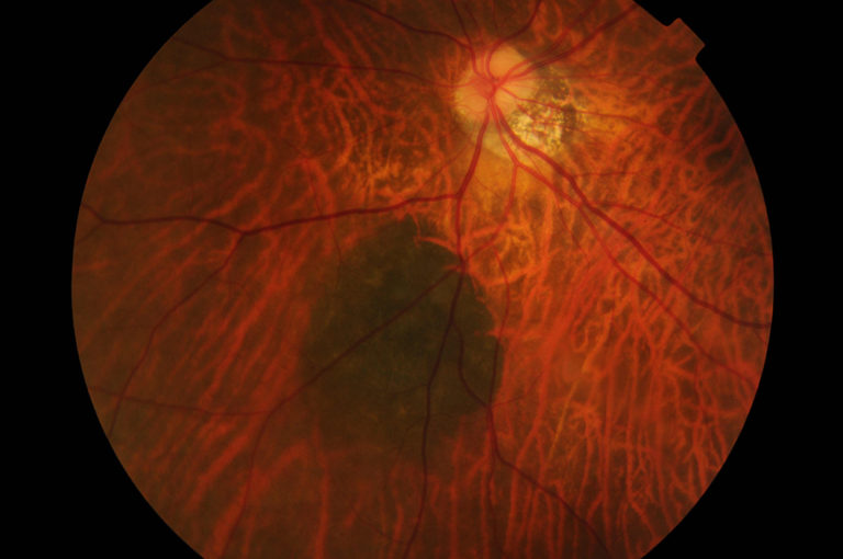 Leading Technology - Retina & Eye Consultants
