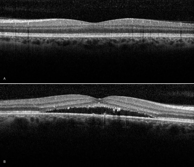 Leading Technology - Retina & Eye Consultants